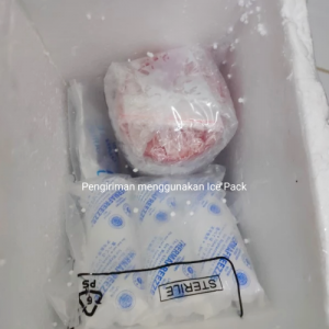 Blood Agar Base (Medium Agar Darah) - LabMart.id