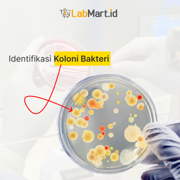 Jenis-Jenis Media Mikrobiologi dan Fungsinya - LabMart.id